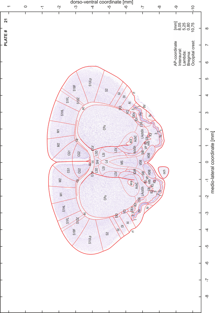 Brain atlas of the Mongolian gerbil ( Meriones unguiculatus ) in CT/MRI ...