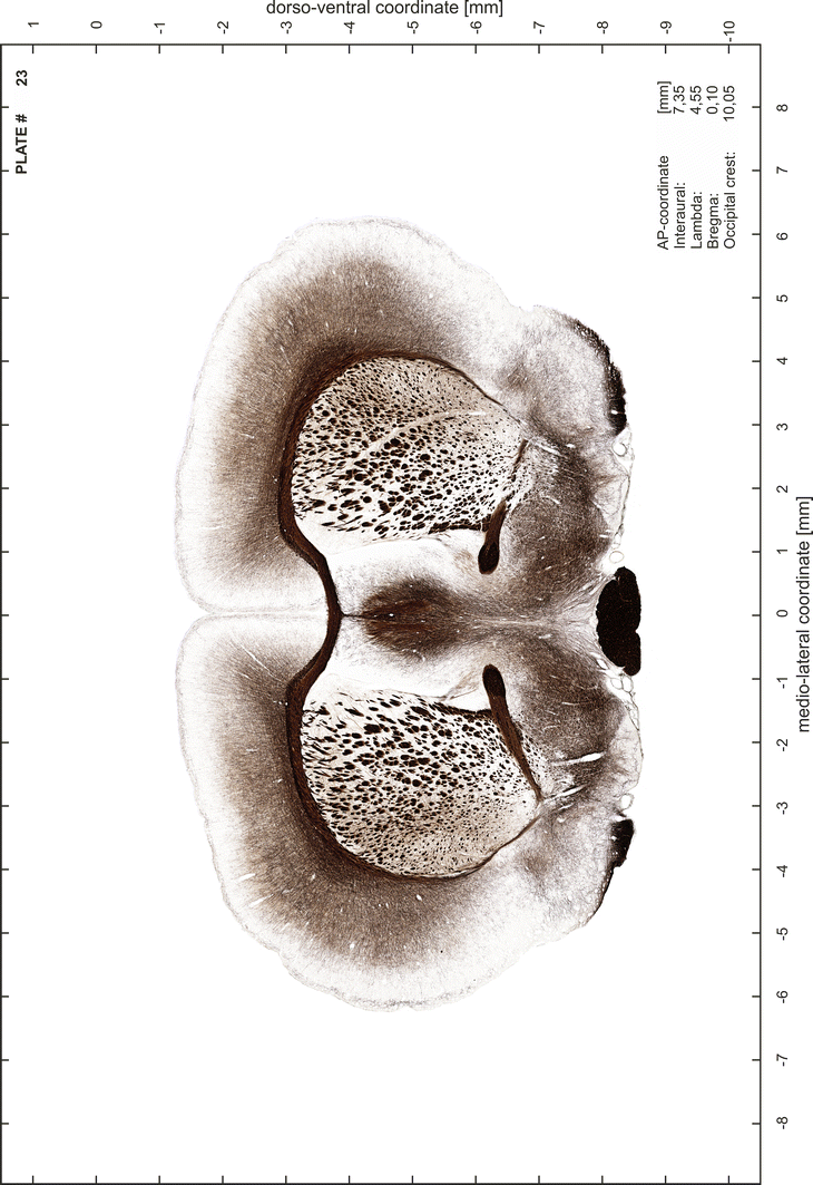 Brain atlas of the Mongolian gerbil ( Meriones unguiculatus ) in CT/MRI ...