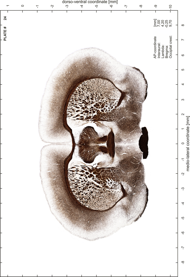 Brain atlas of the Mongolian gerbil ( Meriones unguiculatus ) in CT/MRI ...