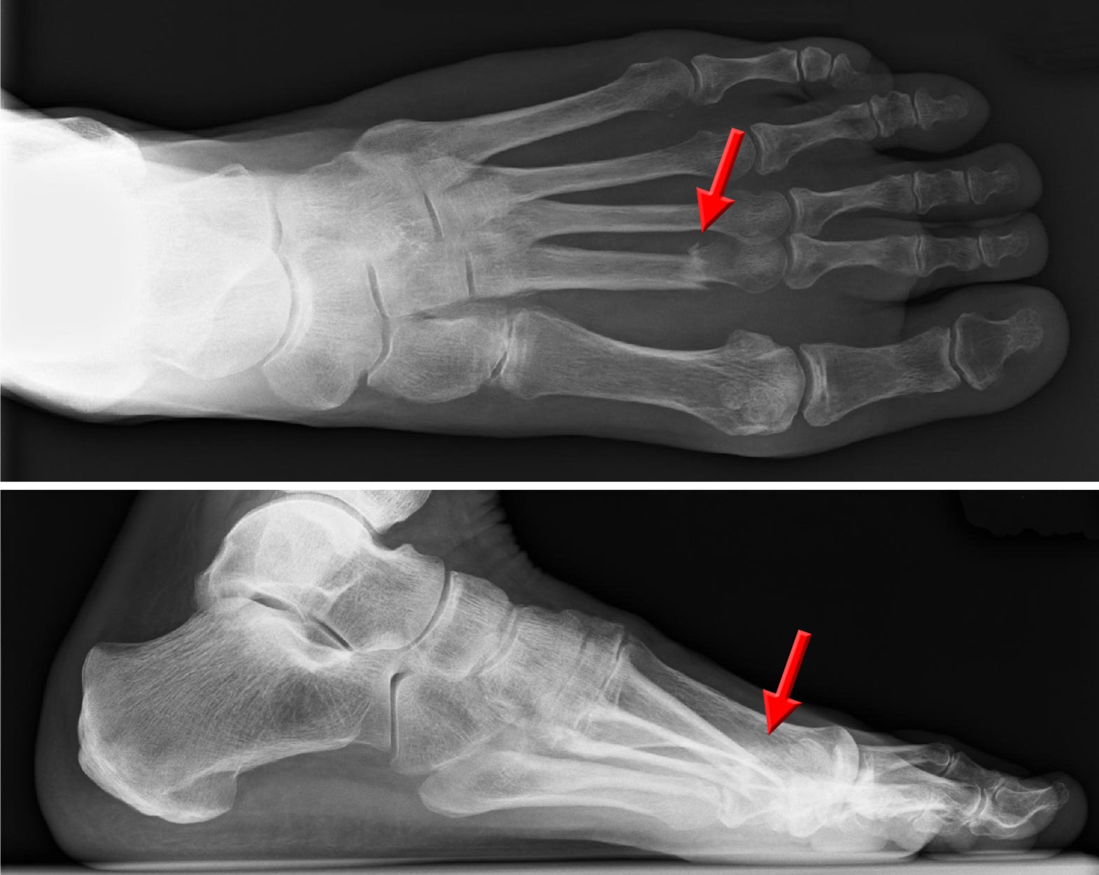 Vom Jakobsweg zermürbt | SpringerLink