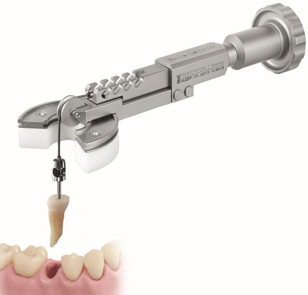 An innovative atraumatic extraction system | British Dental Journal