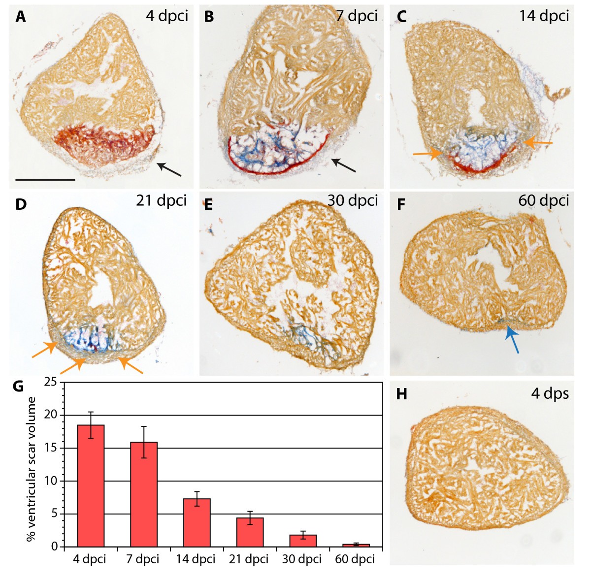 The zebrafish heart regenerates after cryoinjury-induced myocardial ...
