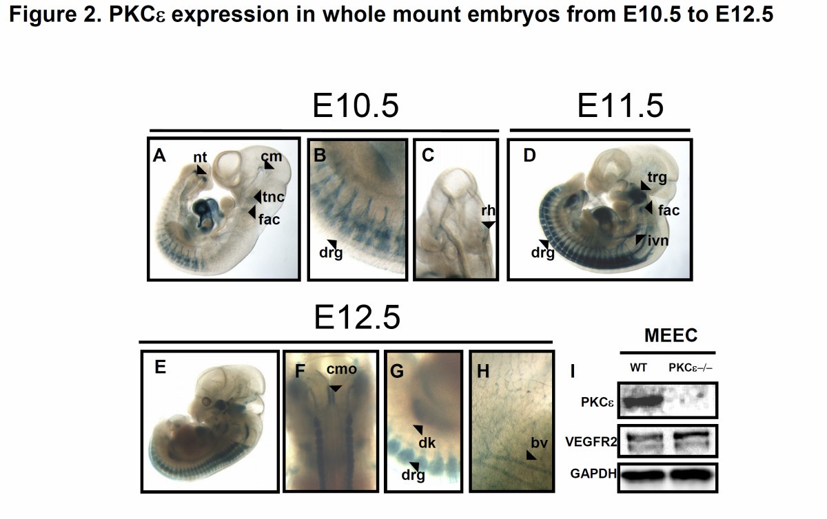 Expression pattern of Protein Kinase C ε during mouse embryogenesis ...