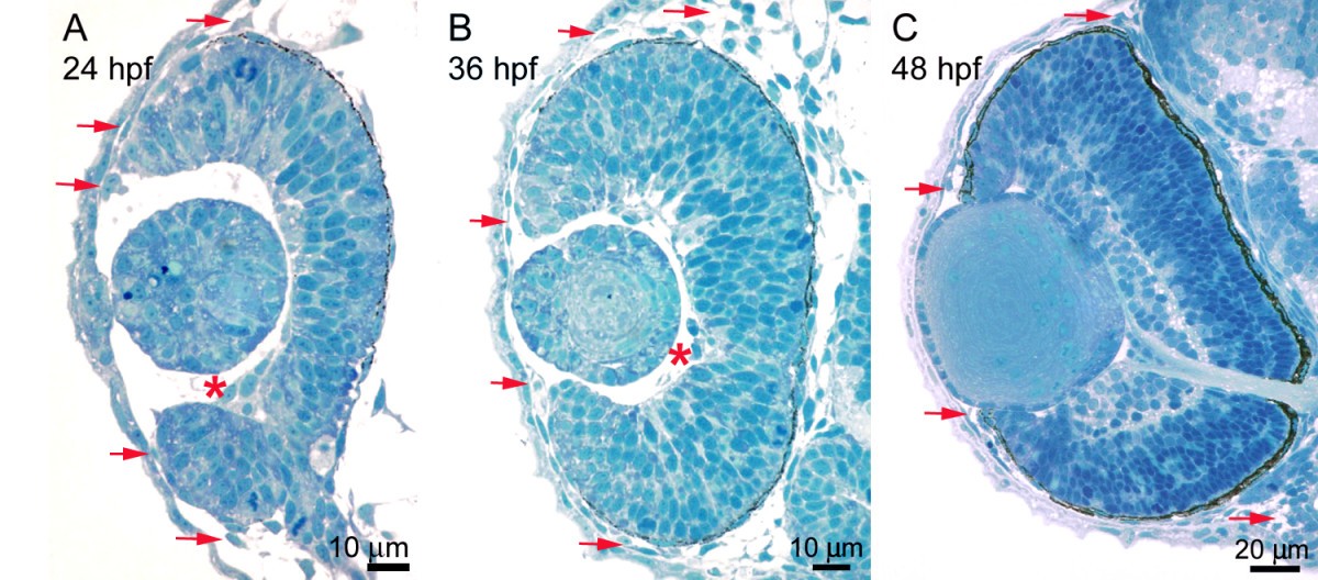 Morphogenesis of the anterior segment in the zebrafish eye | BMC ...