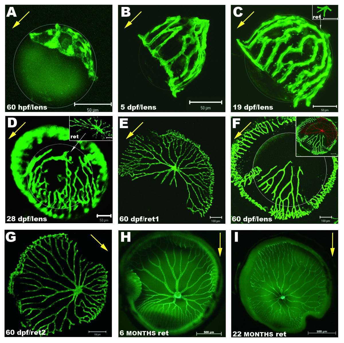 Genetic determinants of hyaloid and retinal vasculature in zebrafish ...