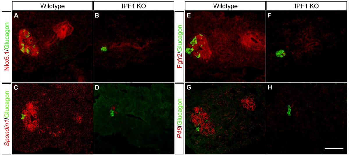 Gene array identification of Ipf1/Pdx1-/-regulated genes in pancreatic ...