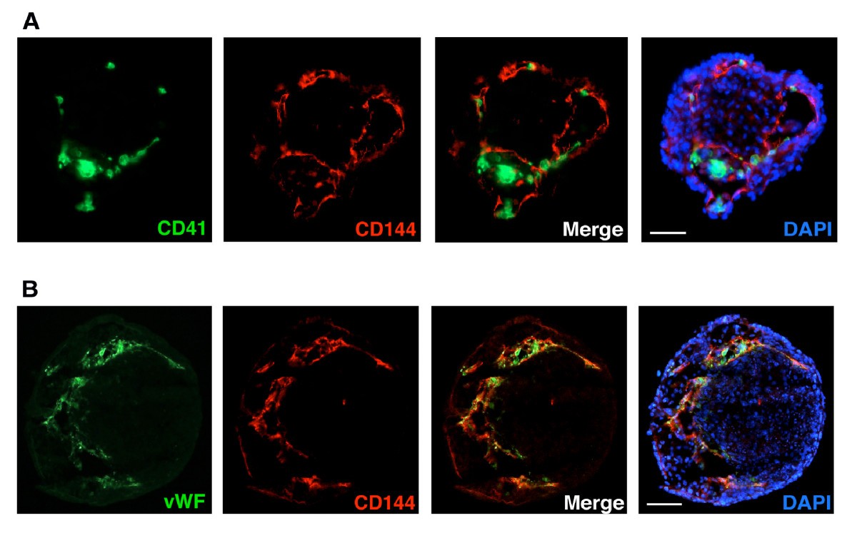 Gene expression analysis of embryonic stem cells expressing VE-cadherin ...
