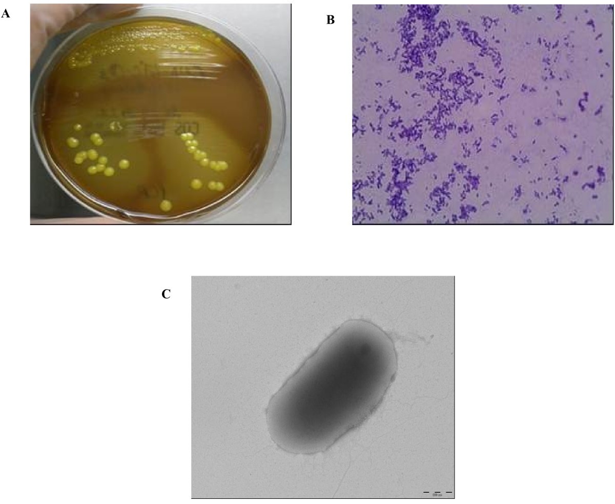 Phenotypic and genotypic properties of Microbacterium yannicii, a ...
