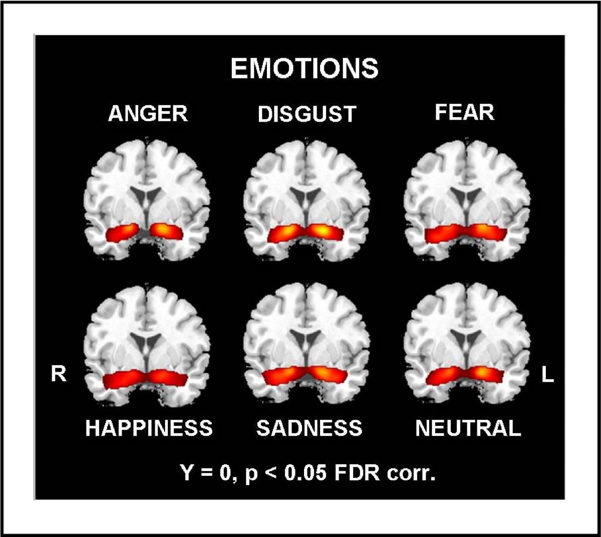General and specific responsiveness of the amygdala during explicit ...