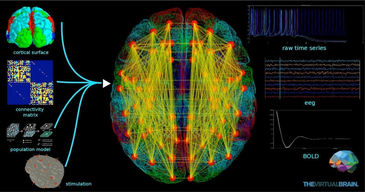 The Virtual Brain: a neuroinformatics platform for simulating large-scale brain network models ...