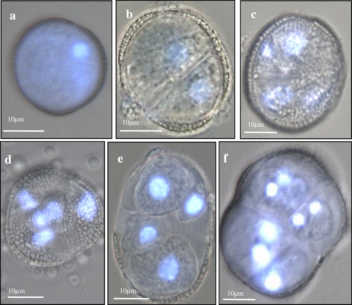 A new microspore embryogenesis system under low temperature which ...