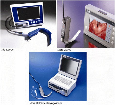 Comparison of the glidescope, CMAC, storz DCI with the Macintosh ...