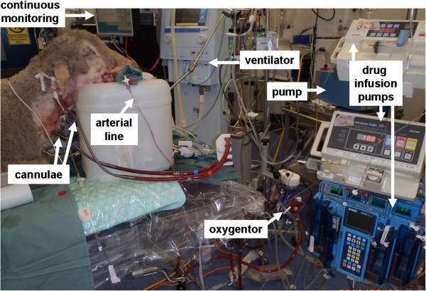 The ECMO PK Project: an incremental research approach to advance ...