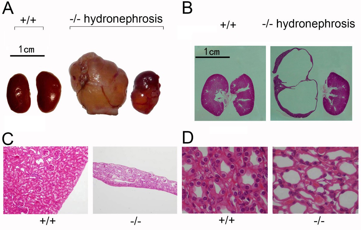 UT-B-deficient mice develop renal dysfunction and structural damage ...