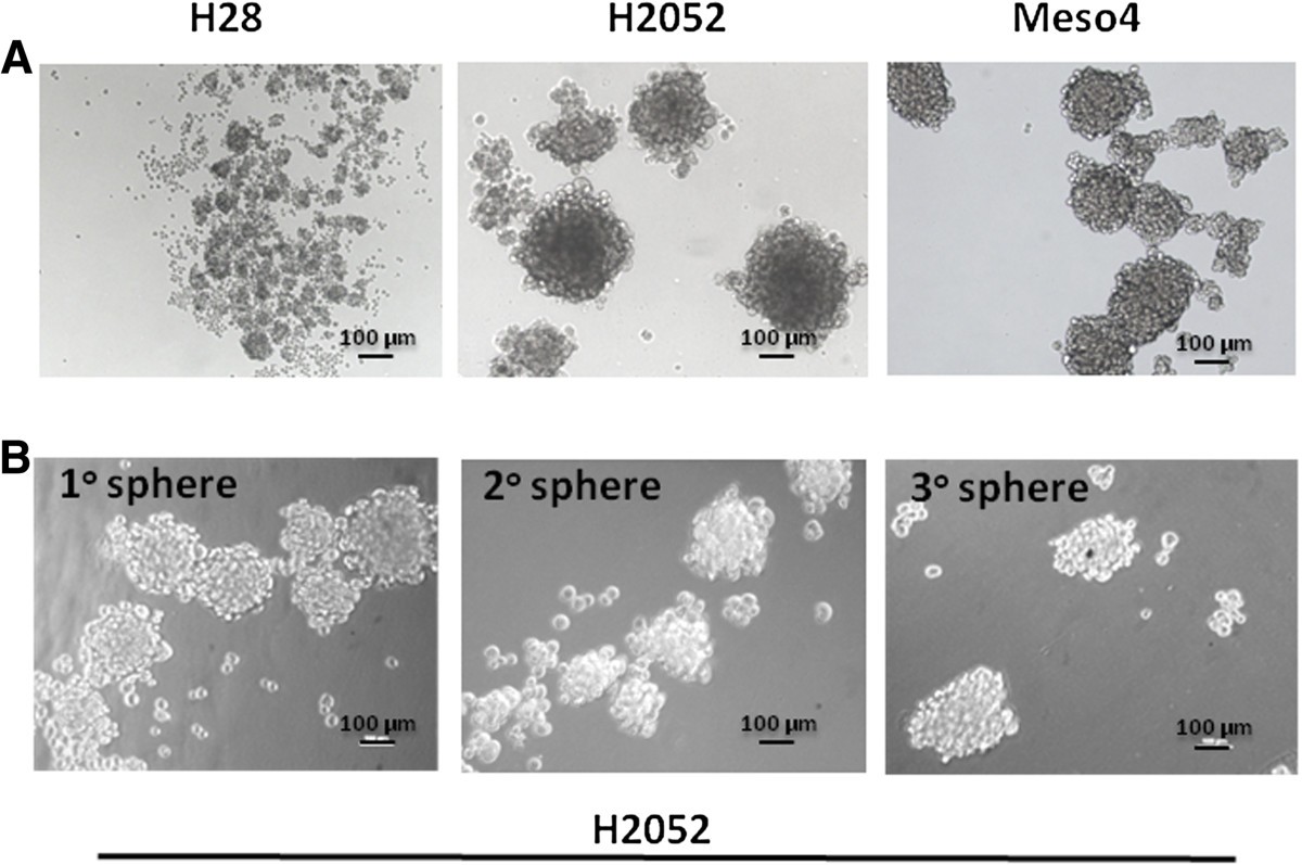 Cisplatin-resistant cells in malignant pleural mesothelioma cell lines ...