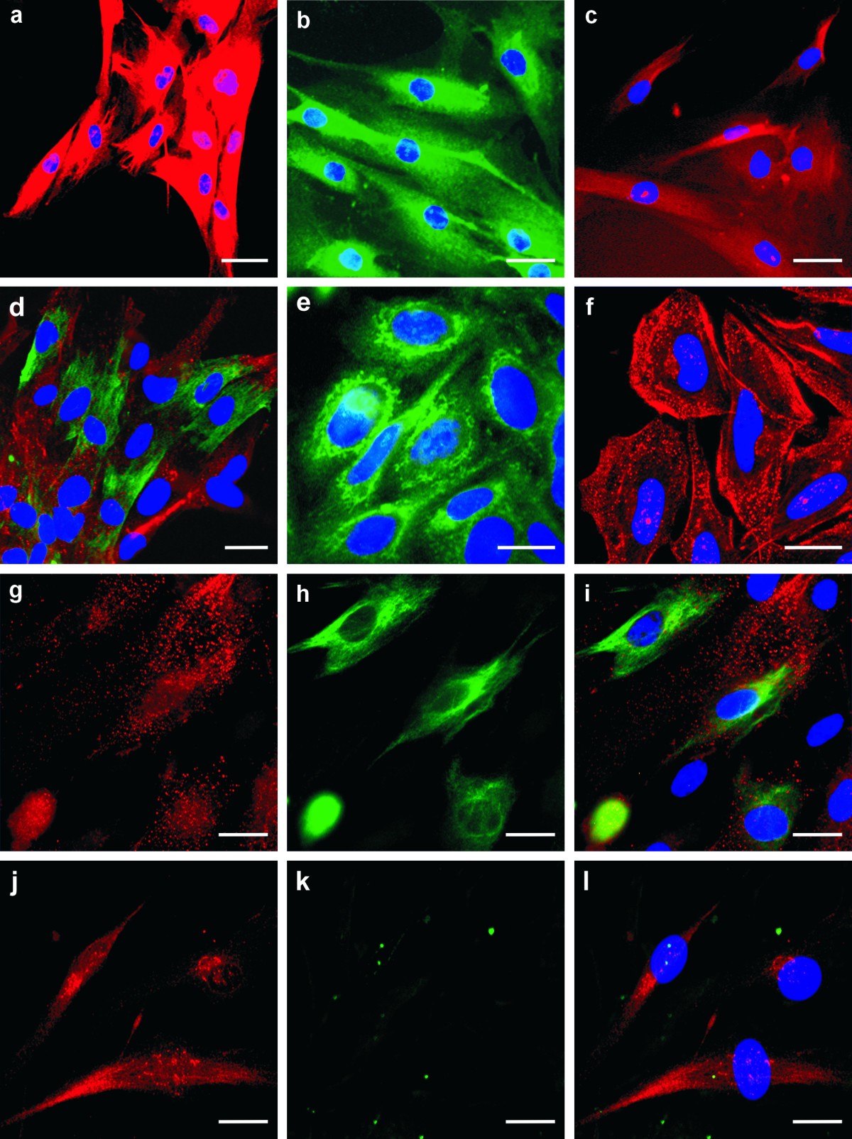 Nestin expression in osteosarcomas and derivation of nestin/CD133 ...