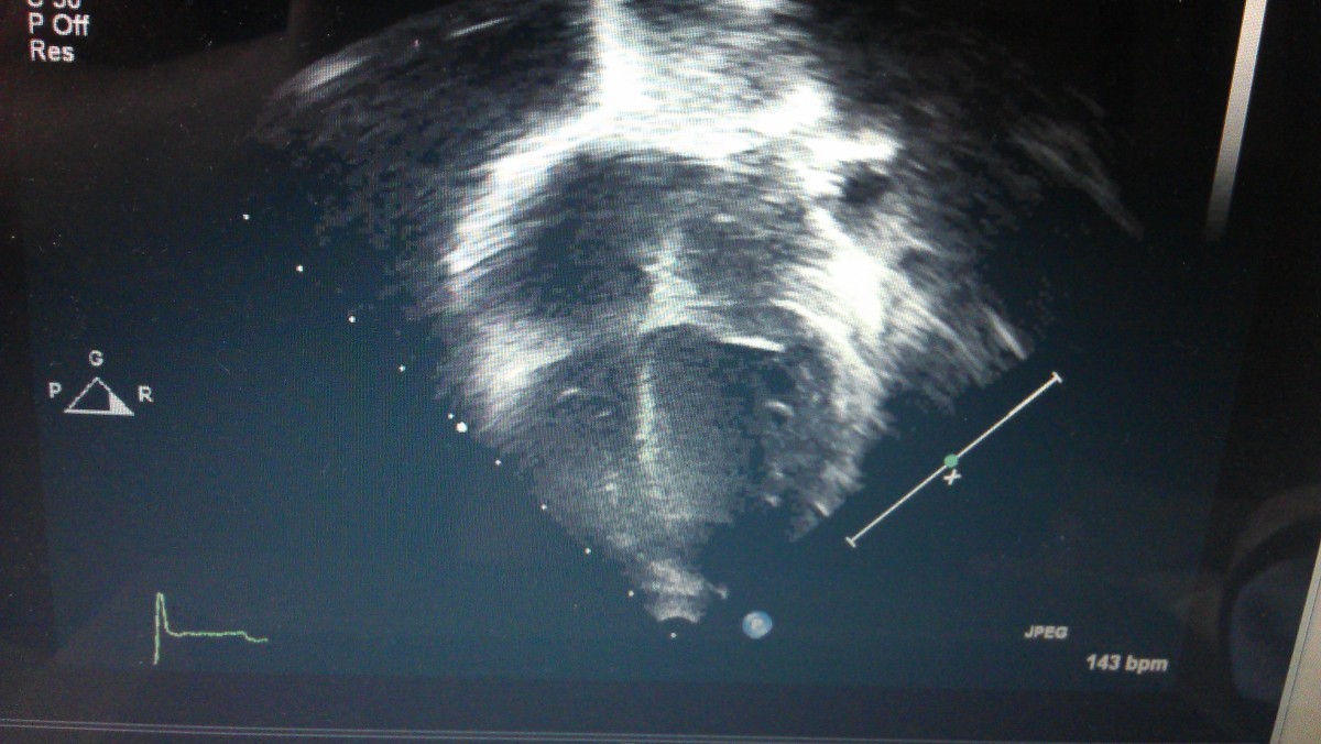 Selenium: a brief review and a case report of selenium responsive ...