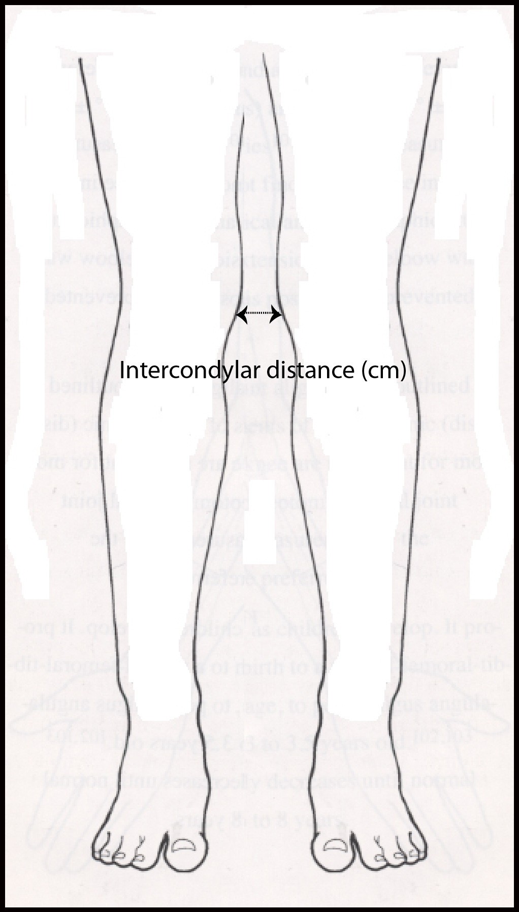 Radiographic knee osteoarthritis in ex-elite table tennis players | BMC ...