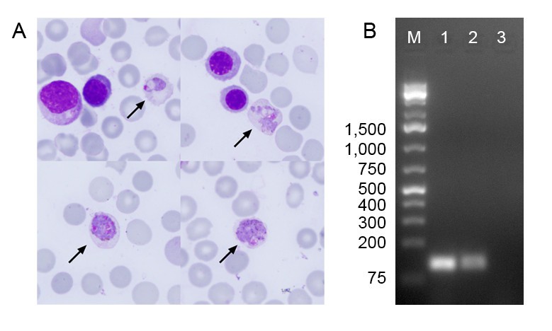 A case of congenital plasmodium vivax malaria from a temperate region ...