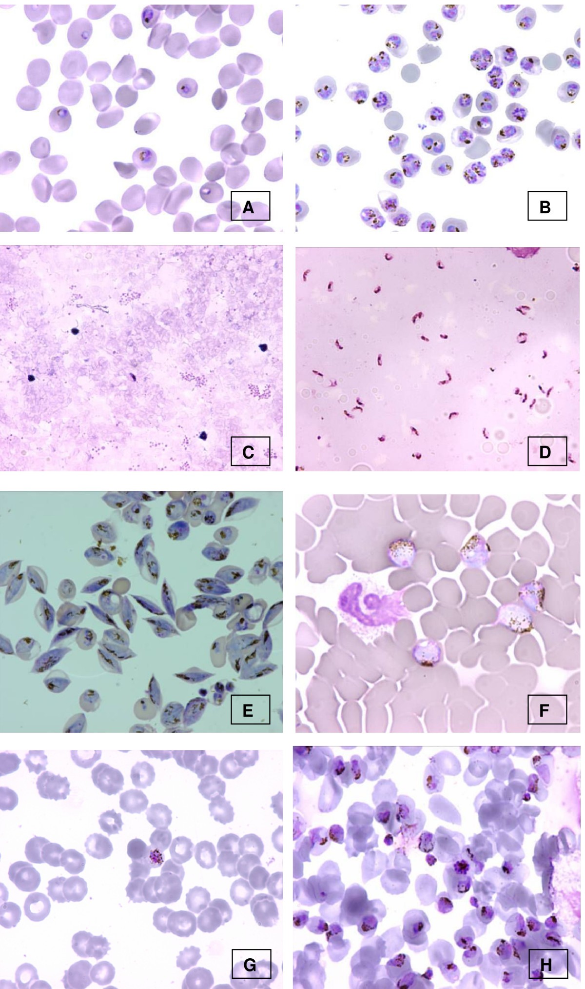 Plasmodium Ovale Gametocyte