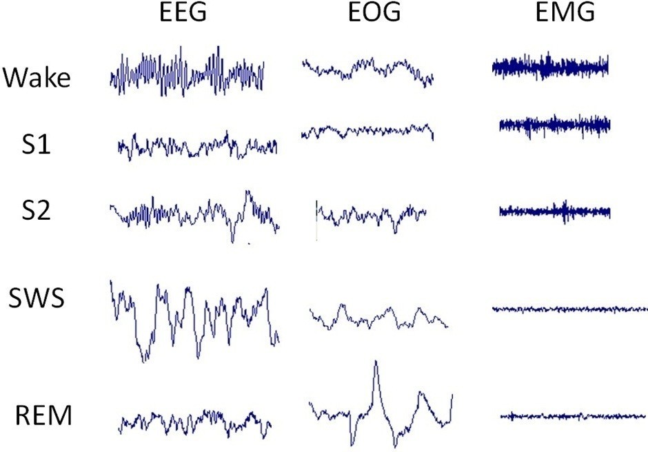 A transition-constrained discrete hidden Markov model for automatic ...