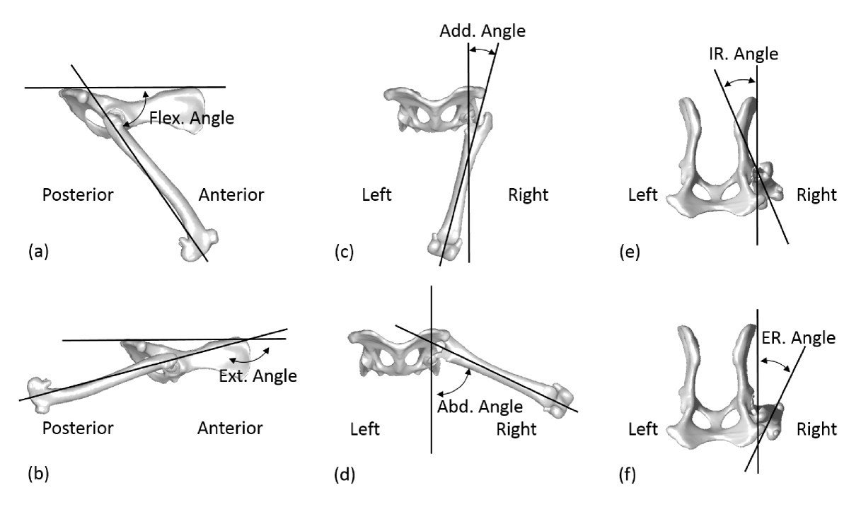 Evaluation of ranges of motion of a new constrained acetabular ...