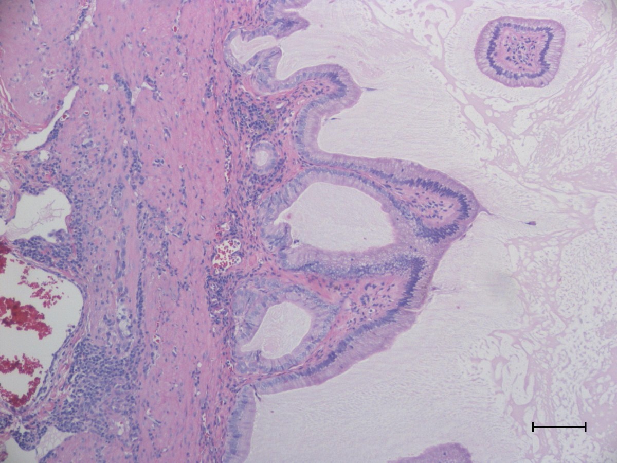 An insertion mutation in ABCB4 is associated with gallbladder mucocele ...