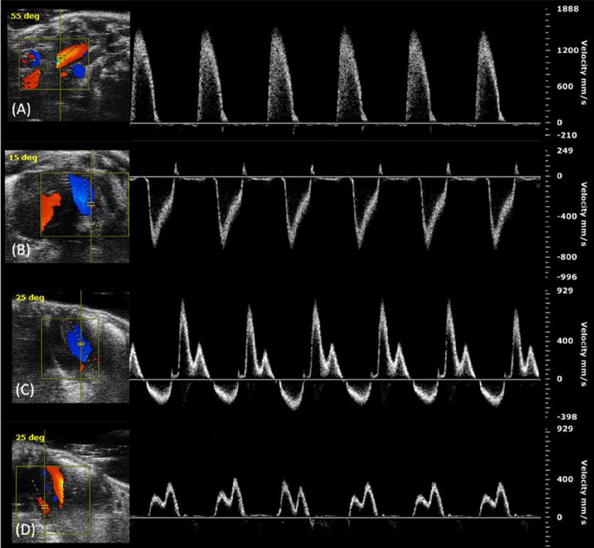 Transthoracic echocardiography reference values in juvenile and adult ...