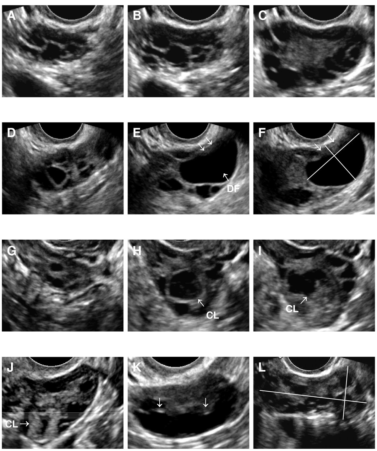 Improving Inter Observer Variability In The Evaluation Of