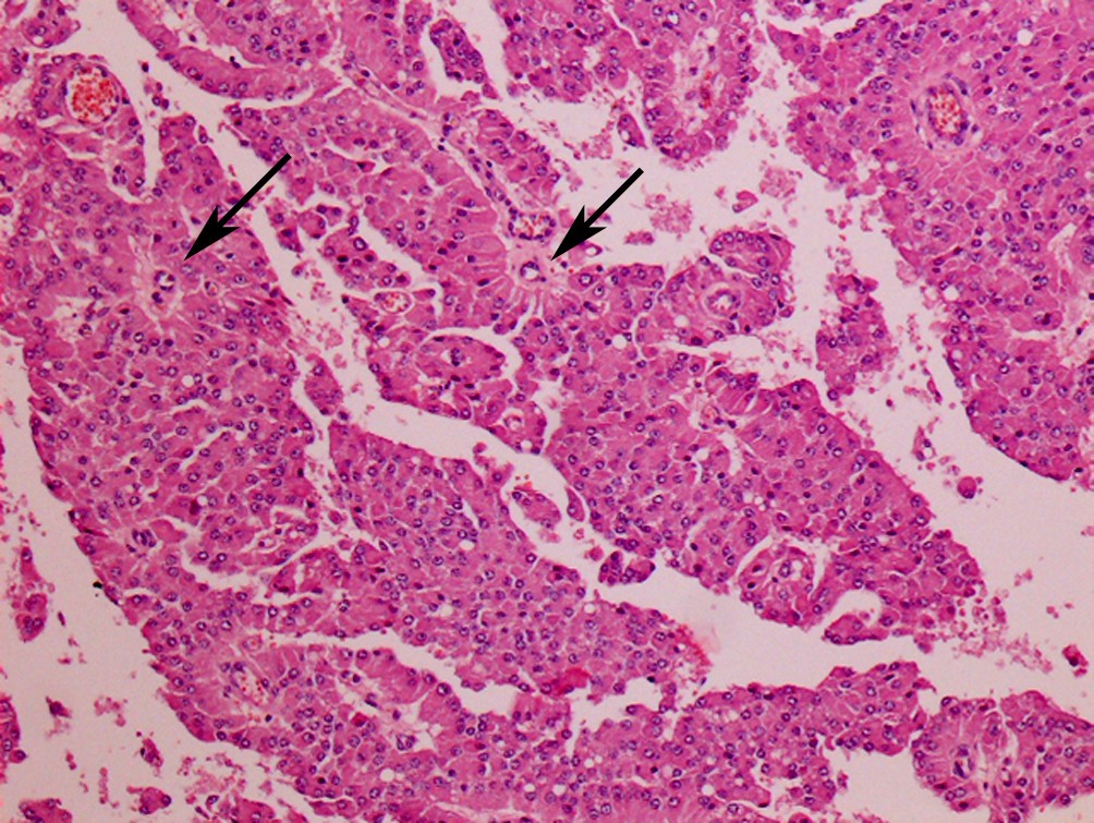 Interstitial Cells Histology