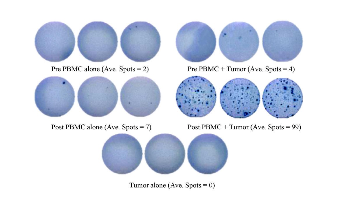 A modified human ELISPOT assay to detect specific responses to primary ...