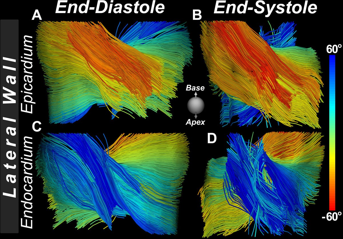 Diffusion MRI tractography of the human heart In Vivo at end-diastole ...