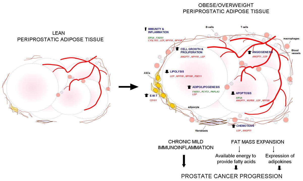 Obesity and prostate cancer: gene expression signature of human ...