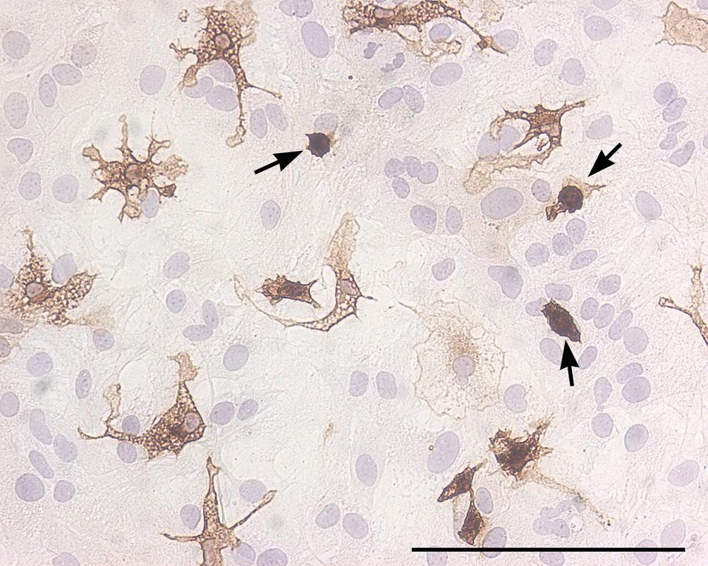 Microglial cells in astroglial cultures: a cautionary note | Journal of ...