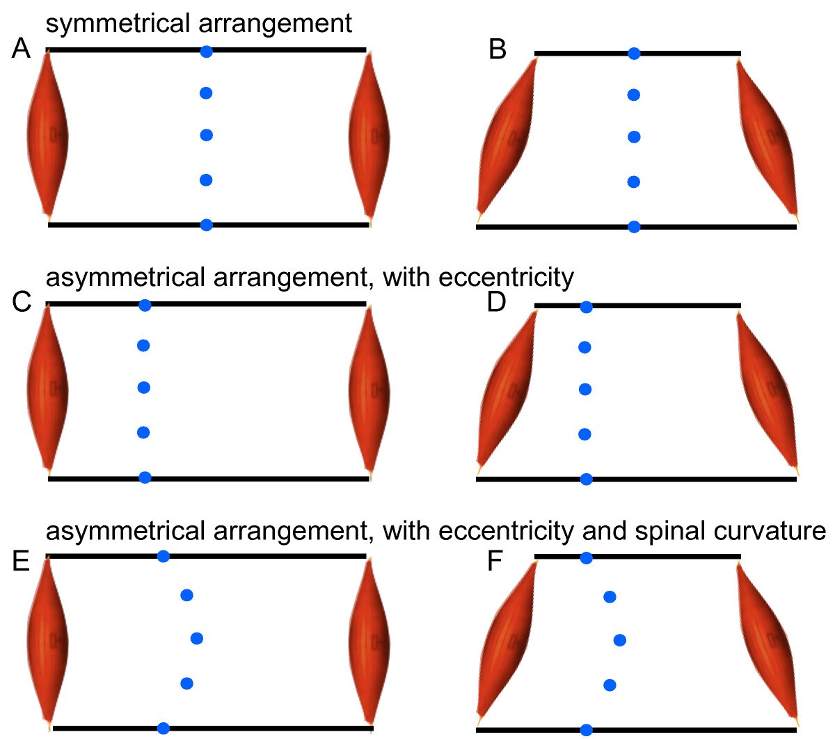 Spinal lordosis optimizes the requirements for a stable erect posture ...
