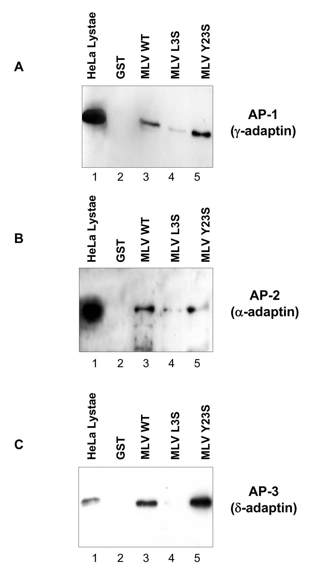 The conserved dileucine- and tyrosine-based motifs in MLV and MPMV ...