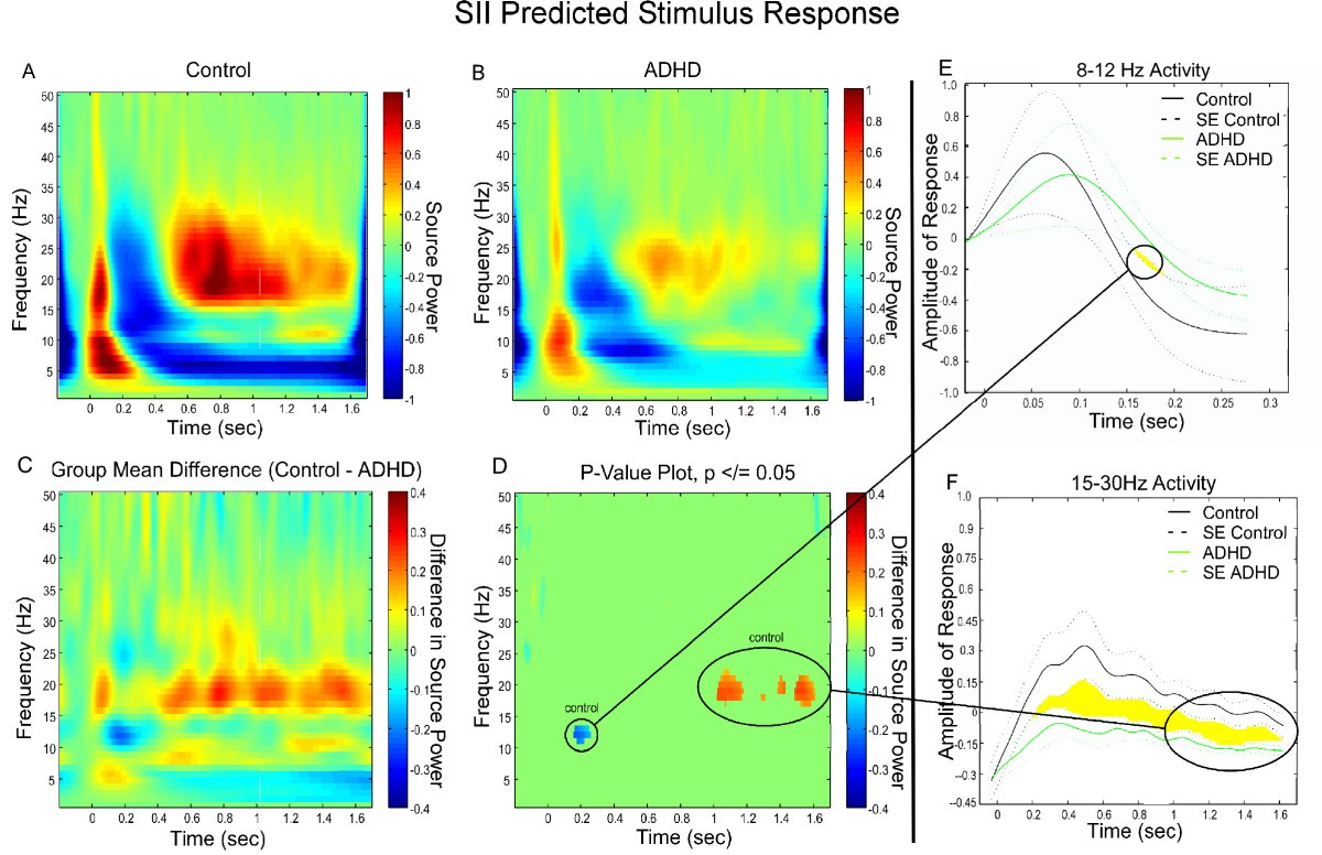 MEG event-related desynchronization and synchronization deficits during basic somatosensory ...