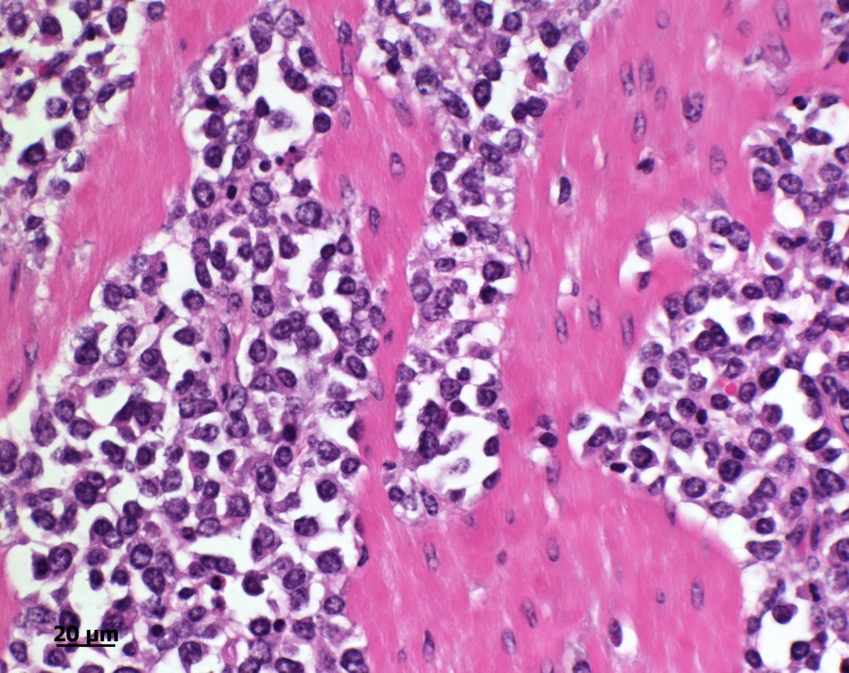 Ultrasonographic findings in a cow with abomasal lymphosarcoma: Case ...