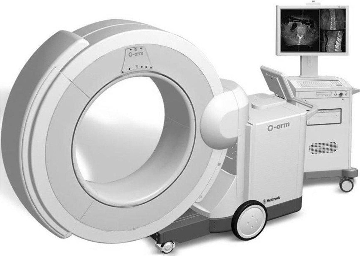 Video-assisted thoracoscopic surgery using mobile computed tomography: New method for locating ...