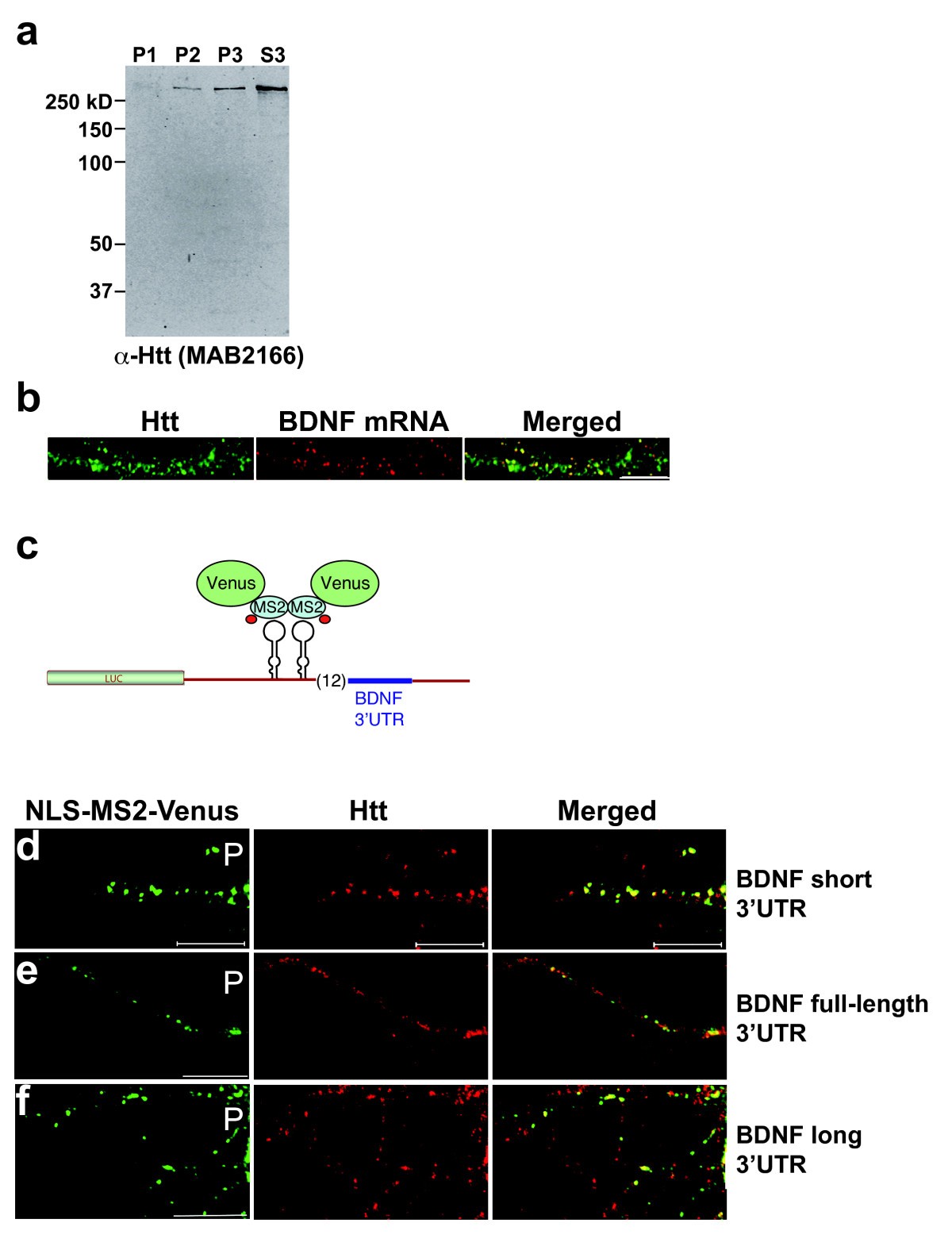 Localization of BDNF mRNA with the Huntington's disease protein in rat ...