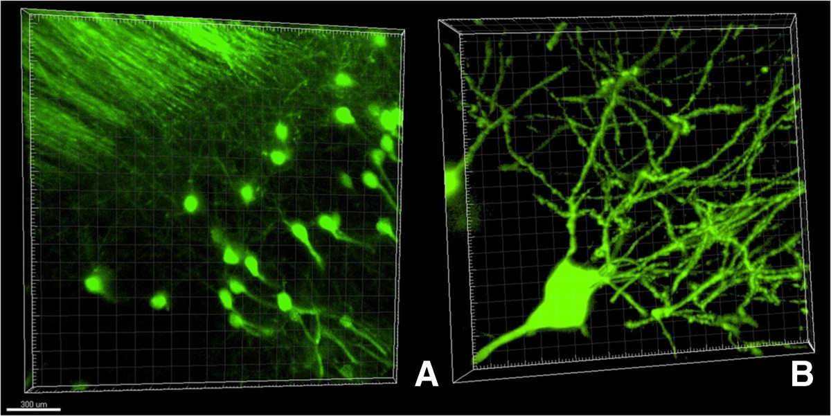 Simplified method to perform CLARITY imaging | Molecular ...