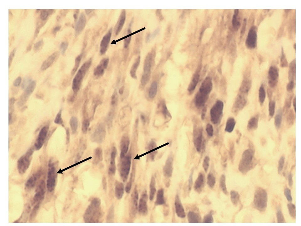 Human herpesvirus-8 (HHV-8) sero-detection and HIV association in ...
