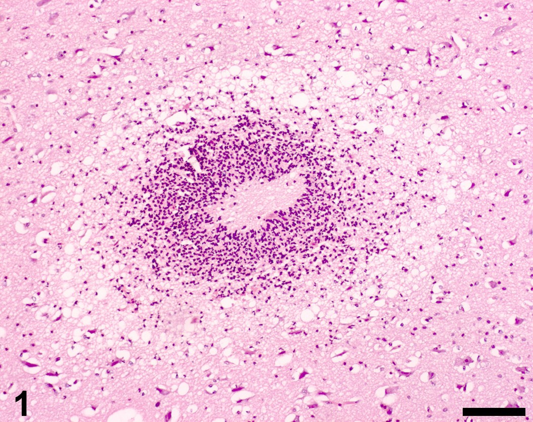 Brain microabscesses in a porcine model of Staphylococcus aureus sepsis ...