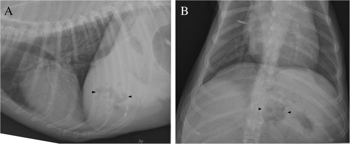 Hepatic emphysema associated with ultrasound-guided liver biopsy in a ...