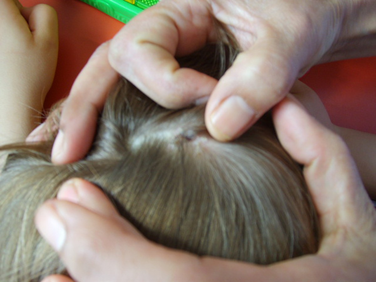 Eschar and neck lymphadenopathy caused by Francisella tularensis after ...