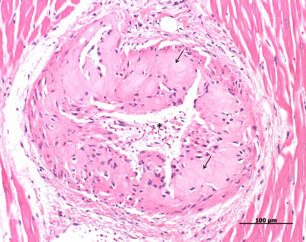 Chlamydia in canine or feline coronary arteriosclerotic lesions | BMC ...