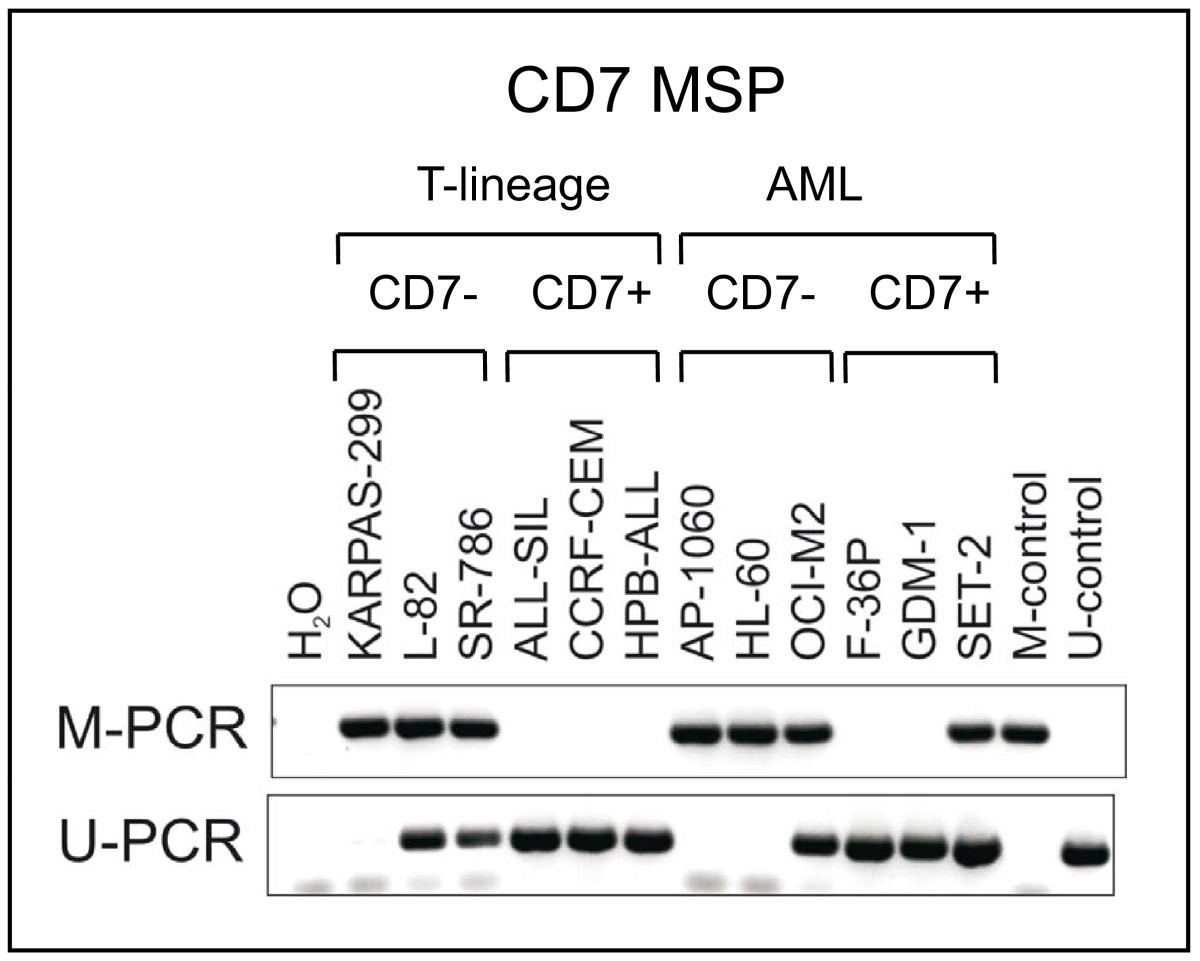CD7 in acute myeloid leukemia: correlation with loss of wild-type CEBPA ...