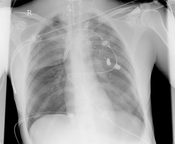 A civilian perspective on ballistic trauma and gunshot injuries ...