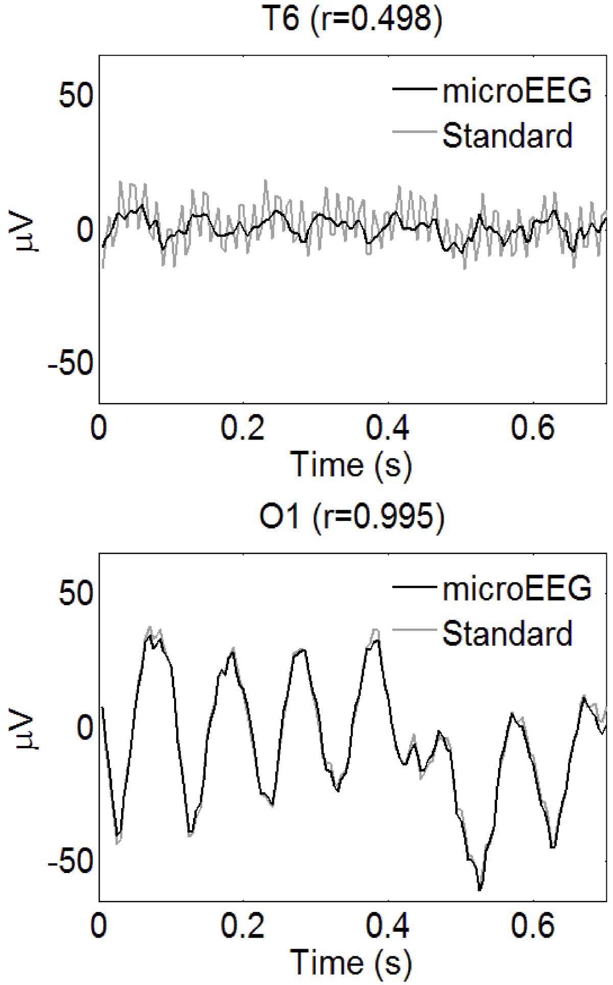 Technical and clinical analysis of microEEG: a miniature wireless EEG ...