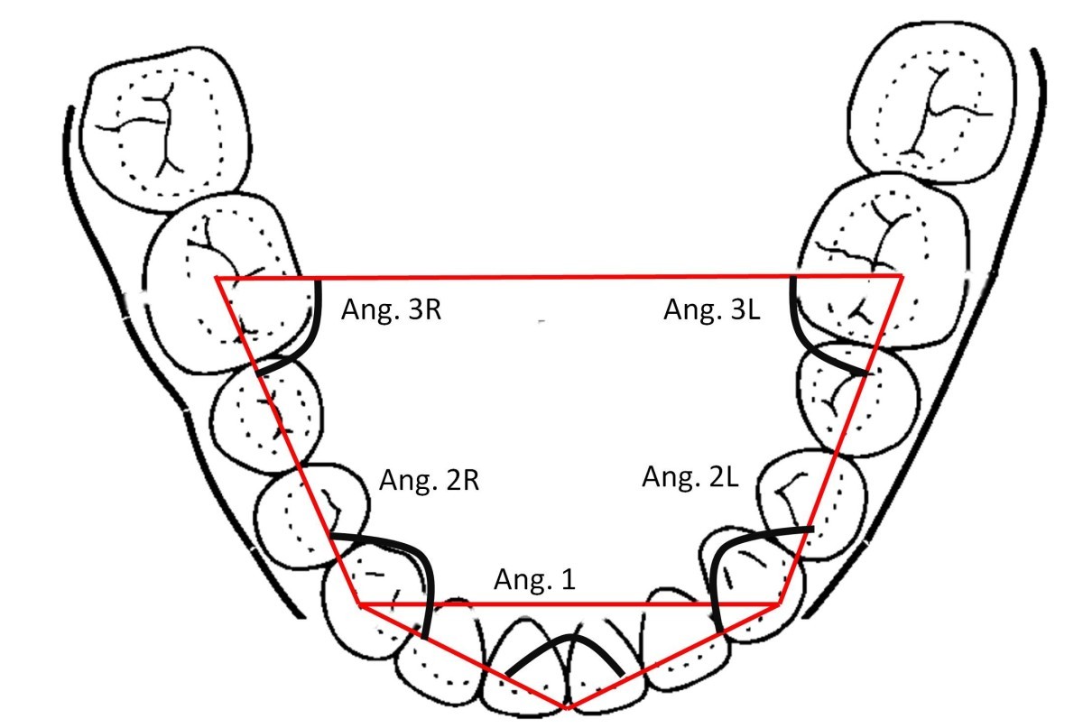 Relationship Between Vertical Facial Patterns And Dental Arch Form In